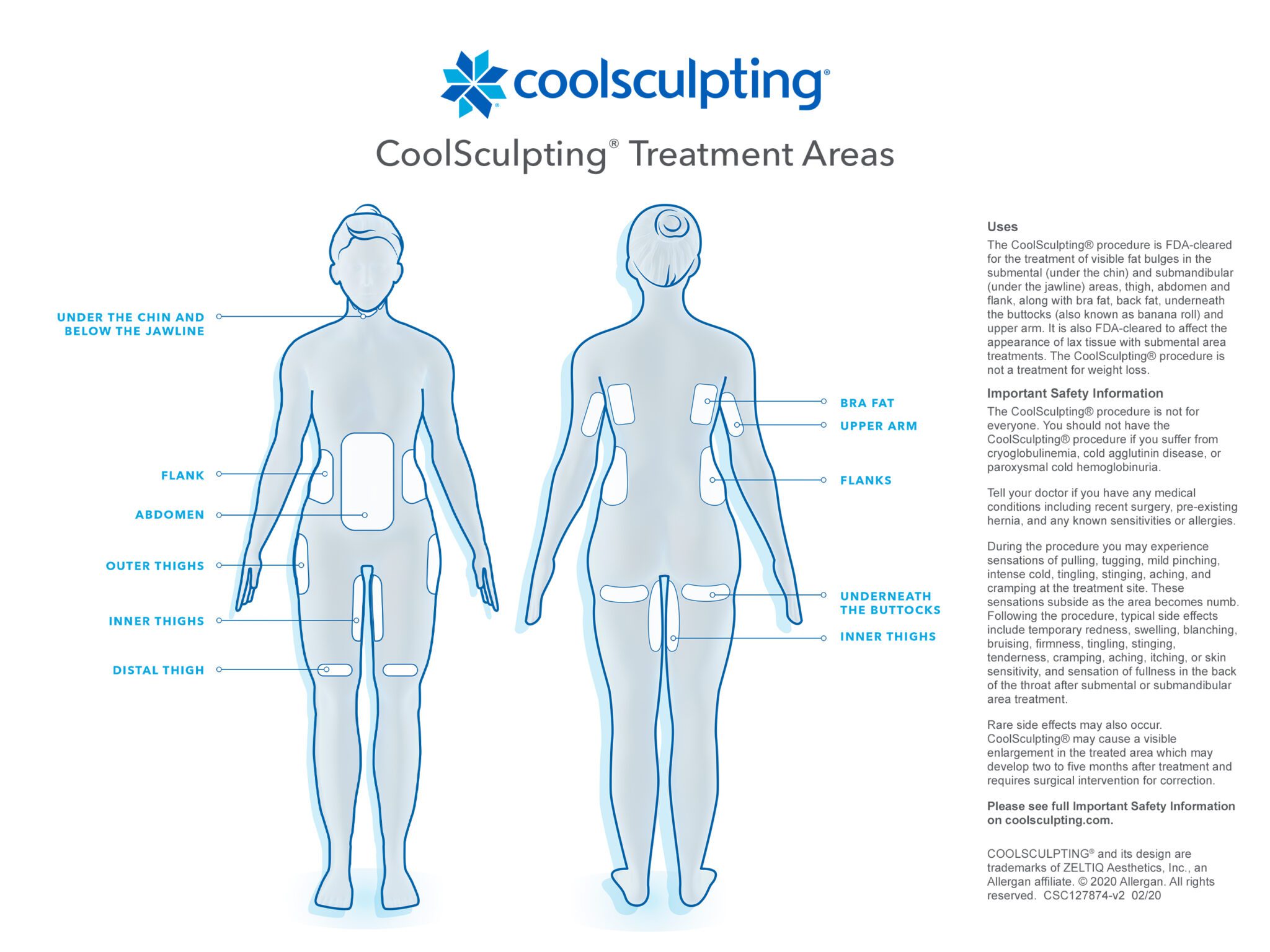 Cool Sculpting in Houston, Texas - Millennium Physicians